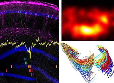 Neural Dynamics Underlying Navigational Planning And Simulation Research And Technology Unil Dnf