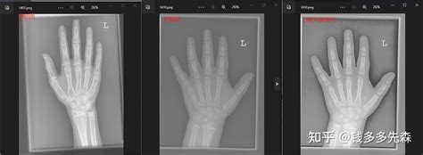 图像处理笔记2 直方图与直方图均衡化histogram Equalization 知乎