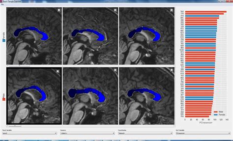 Sample Overview — Braviz Documentation