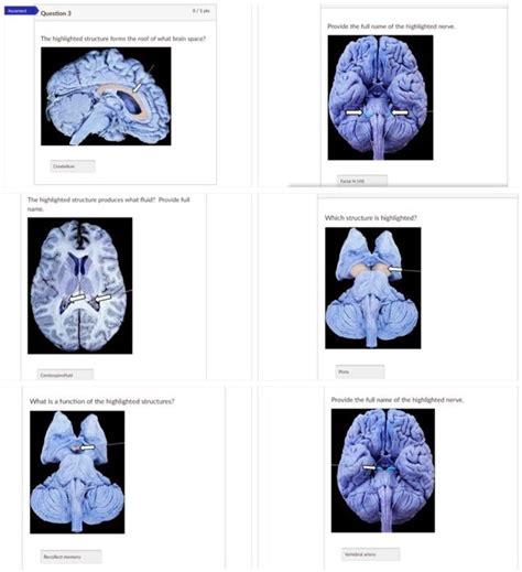 Inconect 81 Question 3 Provide The Full Name Of The Highlighted Nerve