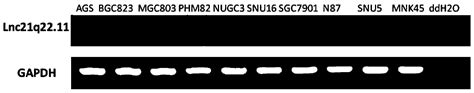 Long Chain Non Coding Rna And Primer Pair And Kit For Detecting The