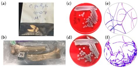 Genomic And Phylogenetic Analysis Of Bacillus Cereus Biovar Anthracis
