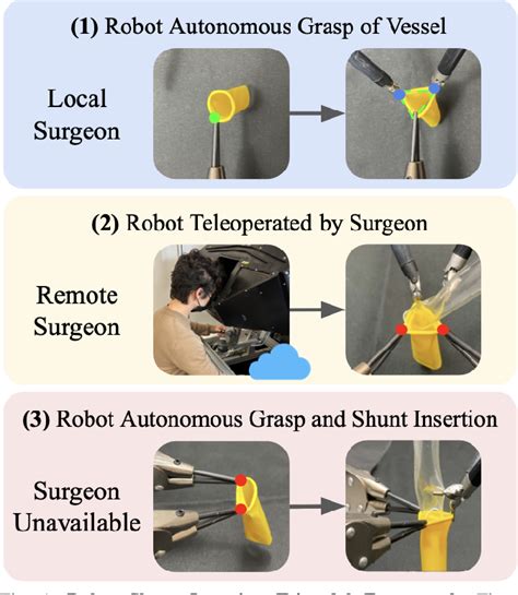 Figure 1 From A Trimodal Framework For Robot Assisted Vascular Shunt Insertion When A