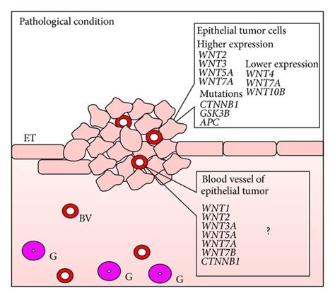 Expression Of Wnt Genes In Endometrial Cancer Et Epithelial Tumor