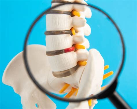 Sciatica Treatment In Dwarka Delhi Centre For Brain And Spine