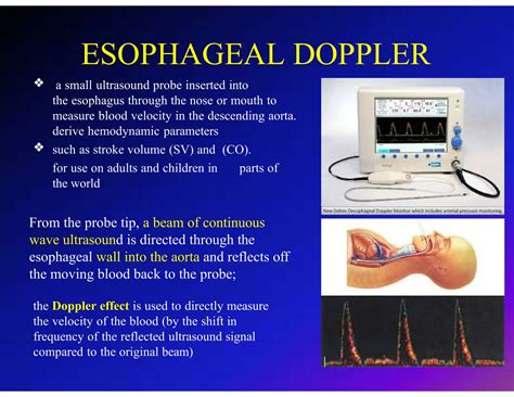 Cardiac Output Cardiac Output Monitoring Pptx