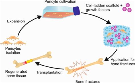 Pericytes And Growth Factors Based Scaffold For Bone Regeneration Download Scientific Diagram