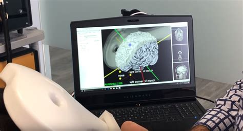 Neuronavigation Part 1 Neurospa Brain Rejuvenation Center