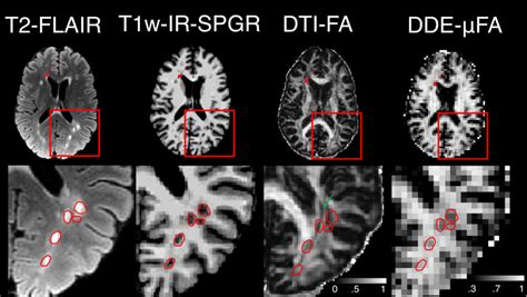 Double Diffusion Encoding MRI For The Clinic Radiological Sciences Laboratory RSL Stanford