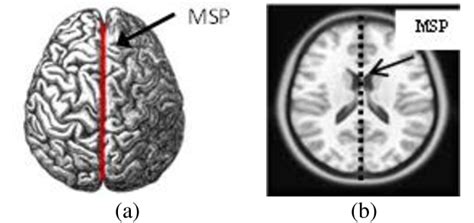 The Msp Plotted On The Human Brain A Msp Visible In The Red Line And