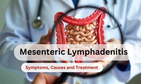 Mesenteric Lymphadenitis Symptoms Causes And Treatment