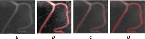 segmentation results of cv model rsf model and m‐wrsf model a raw