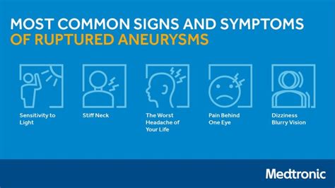 Nicolas Viault On Linkedin Aneurysm Flow Diversion