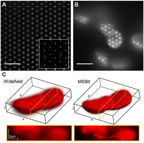 Spatial Light Modulator Based Pattern Generation Allows Implementation