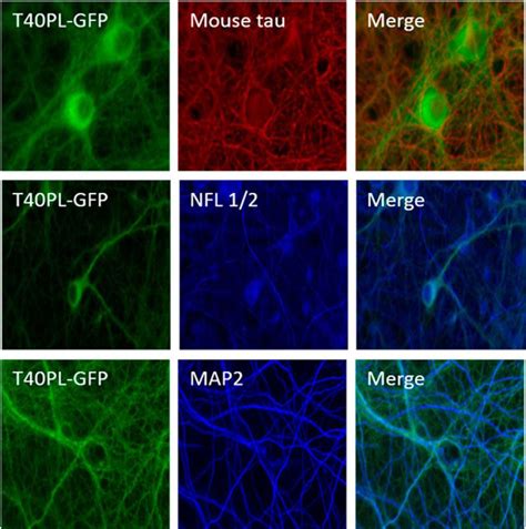 Gfp Mutant Human Tau Transgenic Mice Develop Tauopathy Following Cns