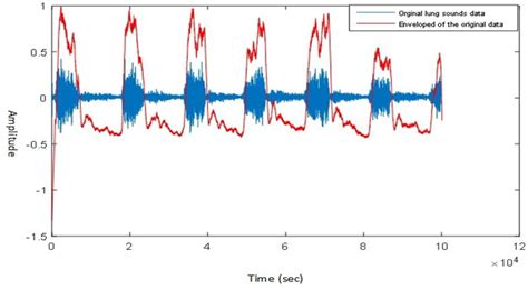 Lung Sounds Ventilation Cycle Segmentation And Classify Healthy Asthma And Copd