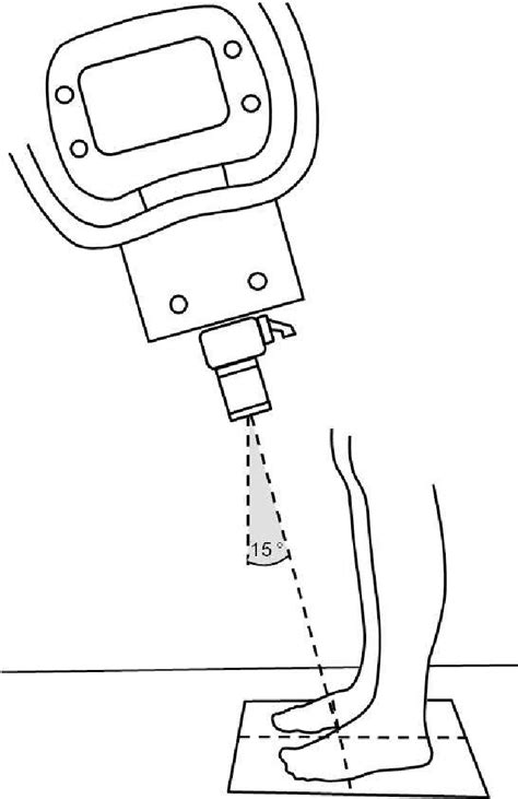 Figure 1 From Validity And Reliability Of Hallux Valgus Angle Measured On Digital Photographs