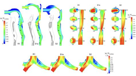 Intersubject Variability Ucy Compsci