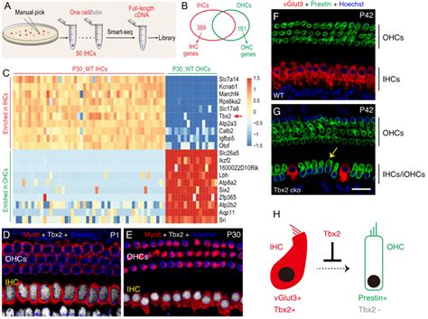 研究发现耳蜗内毛细胞发育和转分化依赖tbx2
