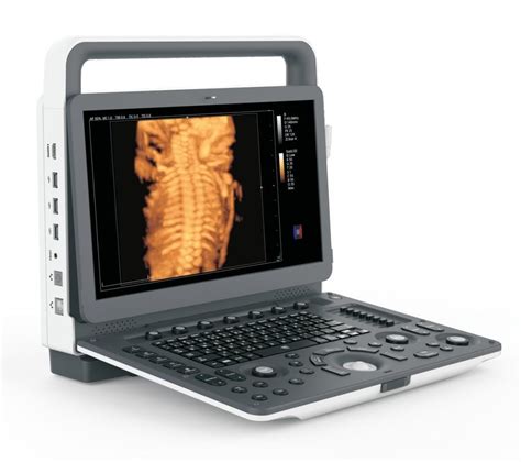 Portable Ultrasound Kamed International