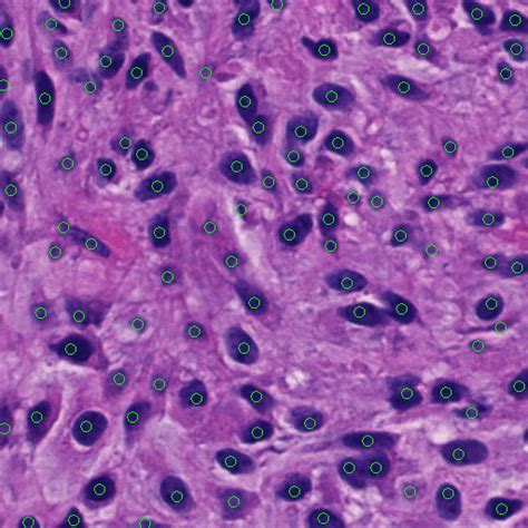 Whole Slide Image Analysis