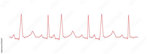 Heartbeat Diagram Ecg Chart Cardiac Rhythm Red Line Cardio Test Sign