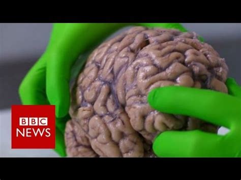 Inside Human Brain