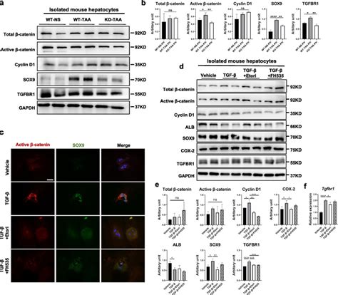 Atypical Cholangiocytes Derived From Hepatocyte Cholangiocyte Transdifferentiation Mediated By