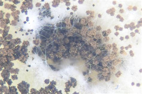 Aspergillus Mold For Microbiology Stock Image Image Of Medicine