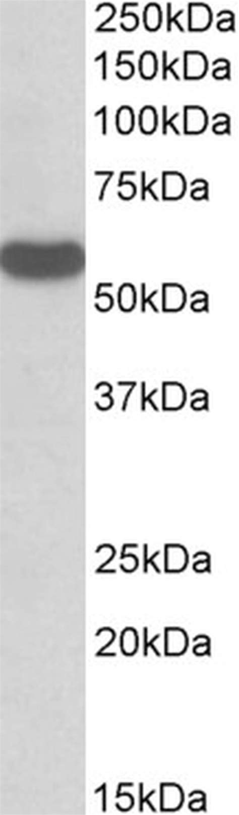 Rtcb Polyclonal Antibody Pa5 142753 Rtcb Polyclonal Antibody Pa5 142753