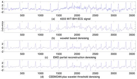 No 203 Mit Bih Ecg Signal De Noising Results Download Scientific