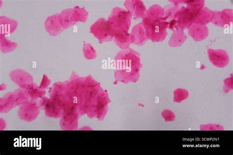 Multiple Squamous Epithelium Under Microscope Stock Videos And Footage