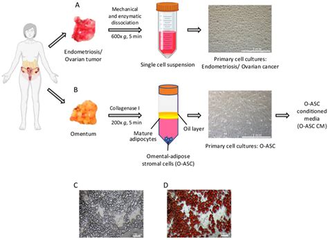 Developing Primary Cell Cultures Of Endometriosis Ovarian Tumors And Download Scientific