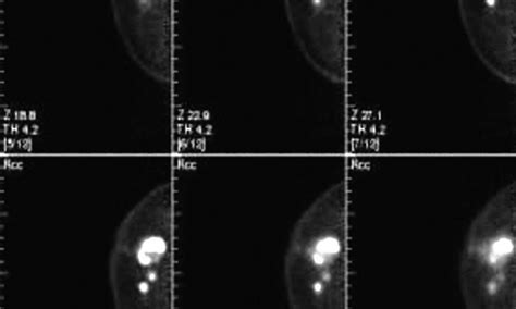 New Optical Breast Imaging System • Healthcare In