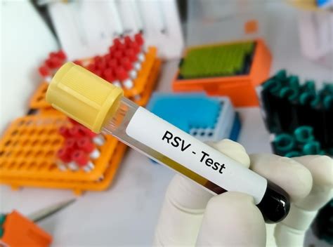 Rsv Pictures