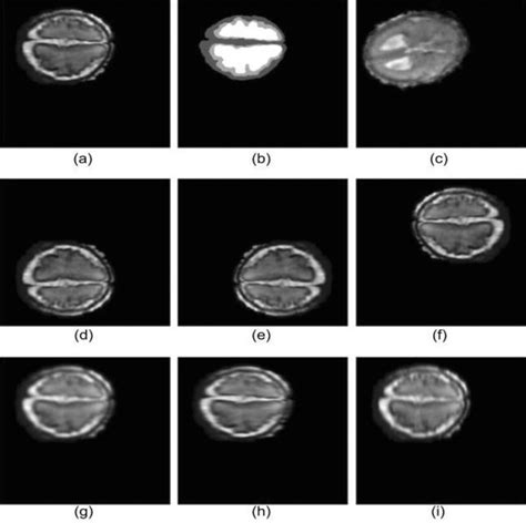 An Example Image Along With Its Segmentation And All The Pre Processing