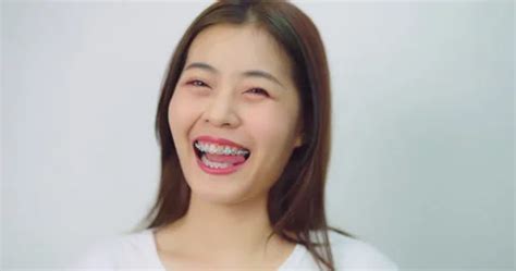 Happy Beautiful Asian Girl With Braces Stock Video Pond