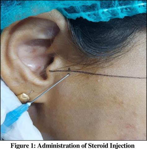 Figure 1 From Comparison Of Efficacy Of Nsaids With Intra Articular