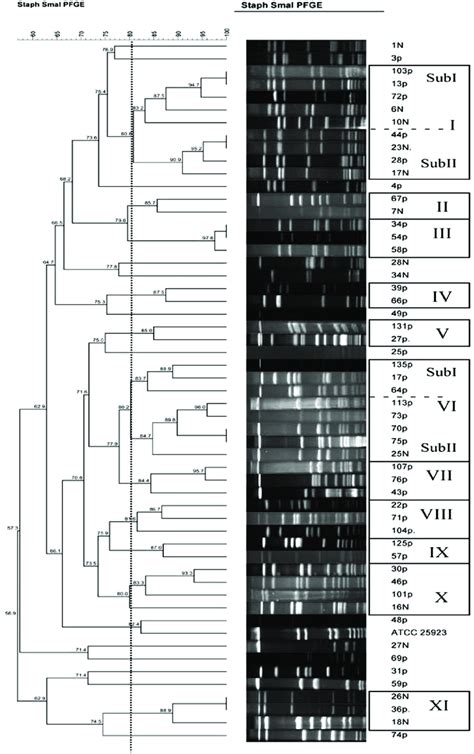 Pfge Dendrogram Of Staphylococcus Aureus Isolates The Vertical Black