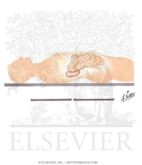 Principle Of Tomography