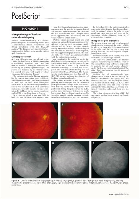 Pdf Artefactual Uniocular Altitudinal Visual Field Defect