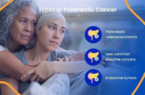 Pancreatic Cancer Warning Signs And Treatment Options Brooksville Actc