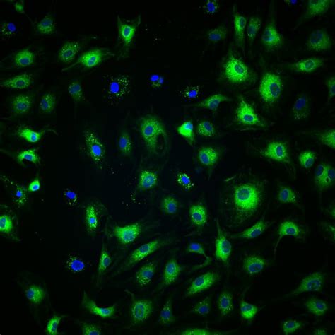 Fluorescent Method To Detect Senescence Associated Beta Galactosidase Kit