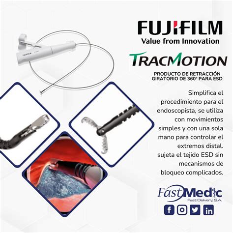 🔁más Control Menos Complicaciones Jose Gonzalez