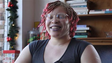 Somalis With Albinism Pelted With Stones And Raw Eggs Bbc News