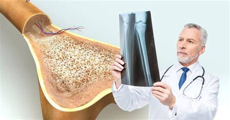 მოამზადეთ კომბოსტოს წვენი მარტივი ინსტრუქციით და მიირთვით რათა გაიძლიეროთ გული ძვლები და იმუნიტეტი