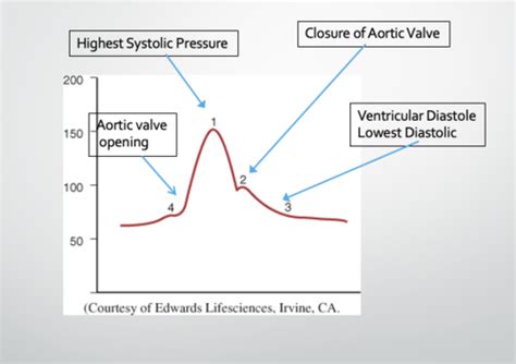 Hemodynamic Monitoring Flashcards Quizlet