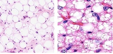 Brown Adipose Connective Tissue