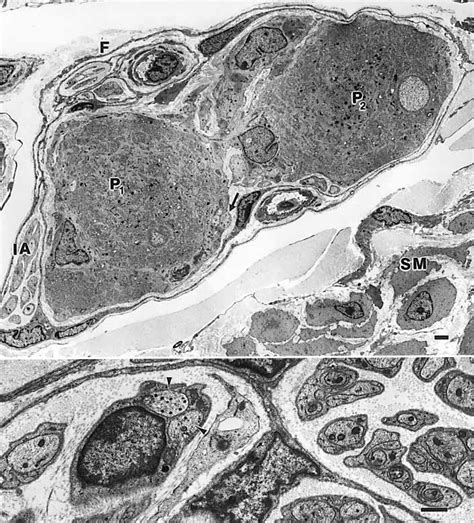 Part Of Intramural Ganglionated Plexus In Ovine Gallbladder A Close