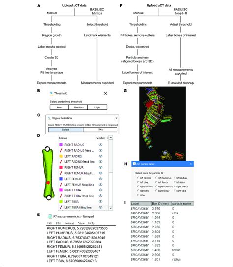 bone automated segmentation and interactive length interrogation of